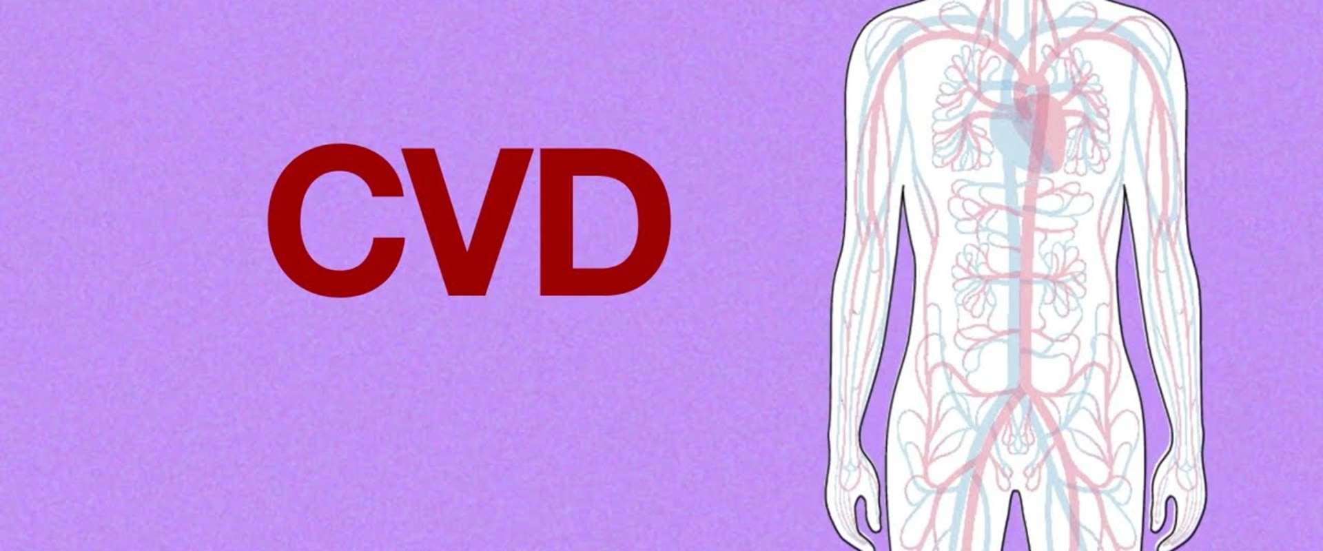 What Does CVD Stand For? A Comprehensive Explanation of Cardiovascular ...